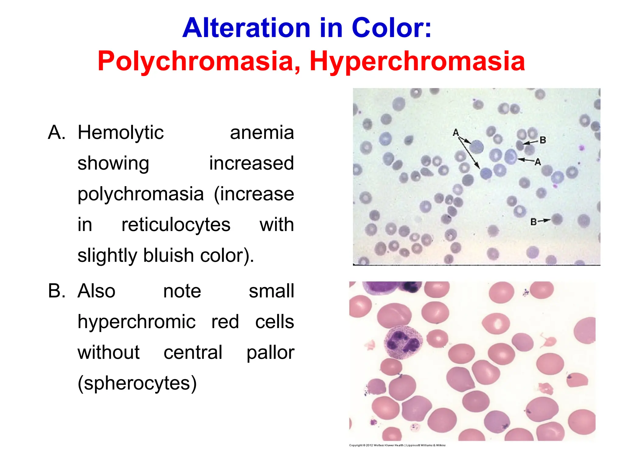 Chapter 7 part I_Abnormalities size, color and distribution.ppt