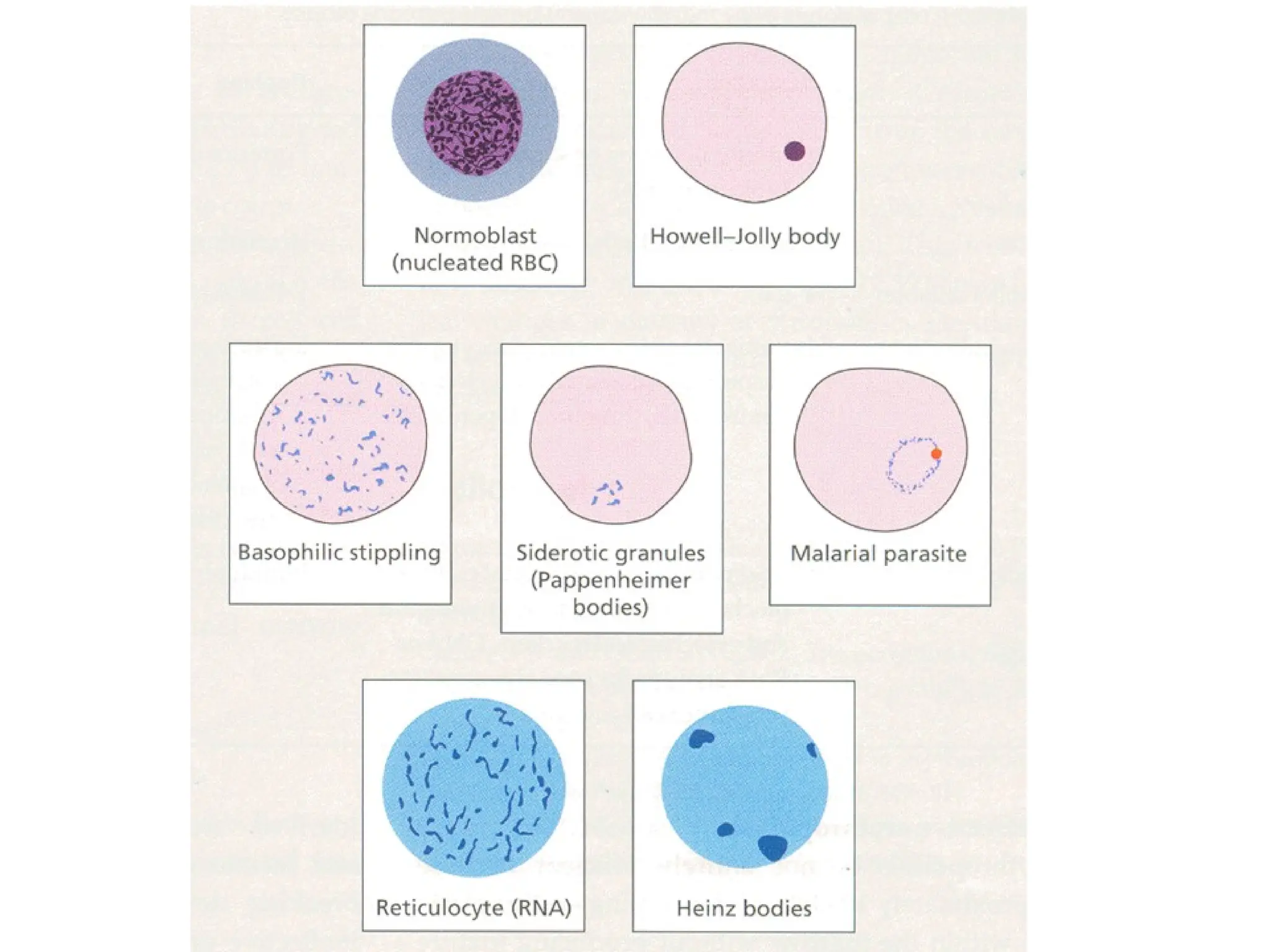 chapter 7 part II_Erythrocyte Inclusions.pptx