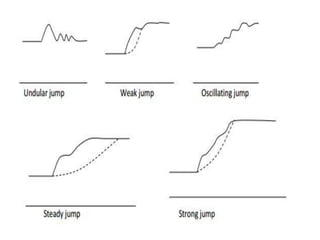 Chapter 8:Hydraulic Jump and its characterstics | PPTX