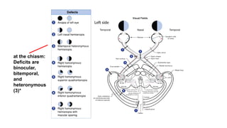 Visual Pathways: Ophthalmology textbook AK khurana comprehensive ...