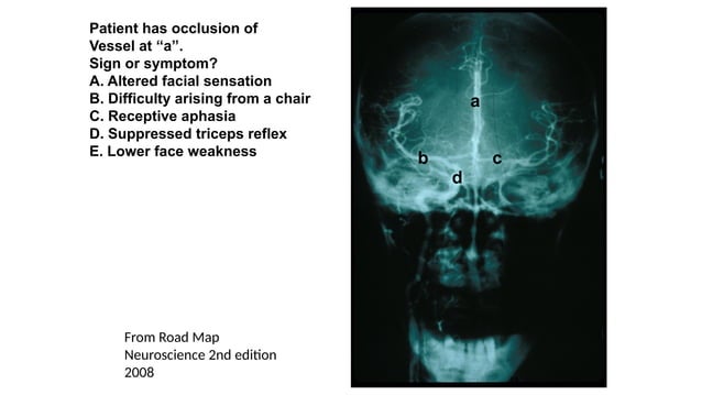 Visual Pathways: Ophthalmology textbook AK khurana comprehensive ...