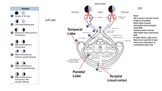 Visual Pathways: Ophthalmology textbook AK khurana comprehensive ...