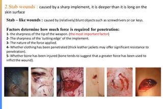 Injuries & trauma Assessment of injury .pdf