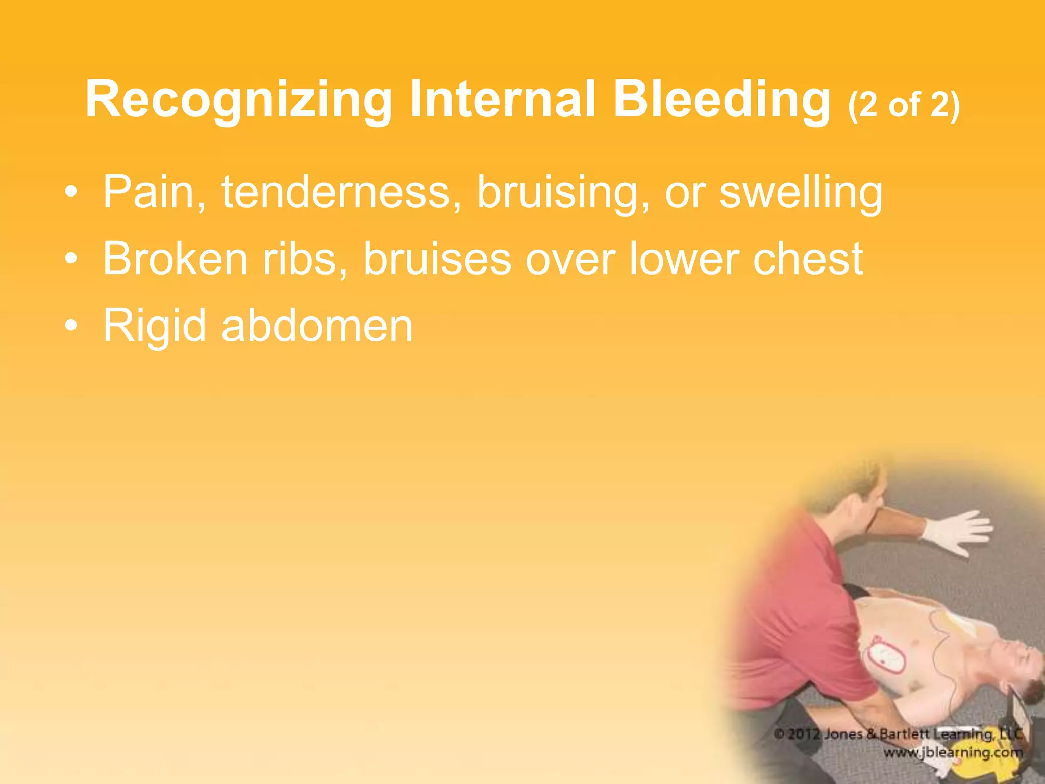 Chapter 8 Bleeding | PPTX