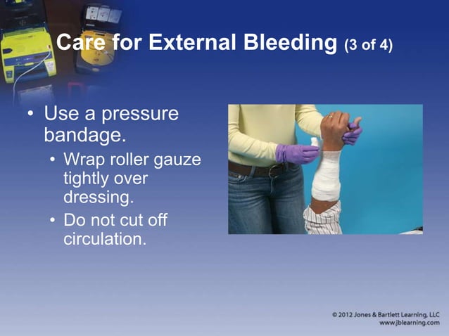 Chapter 8 Bleeding | PPTX | Death, Injury, or Military Conflict | Sensitive Topics