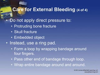 Chapter 8 Bleeding | PPTX