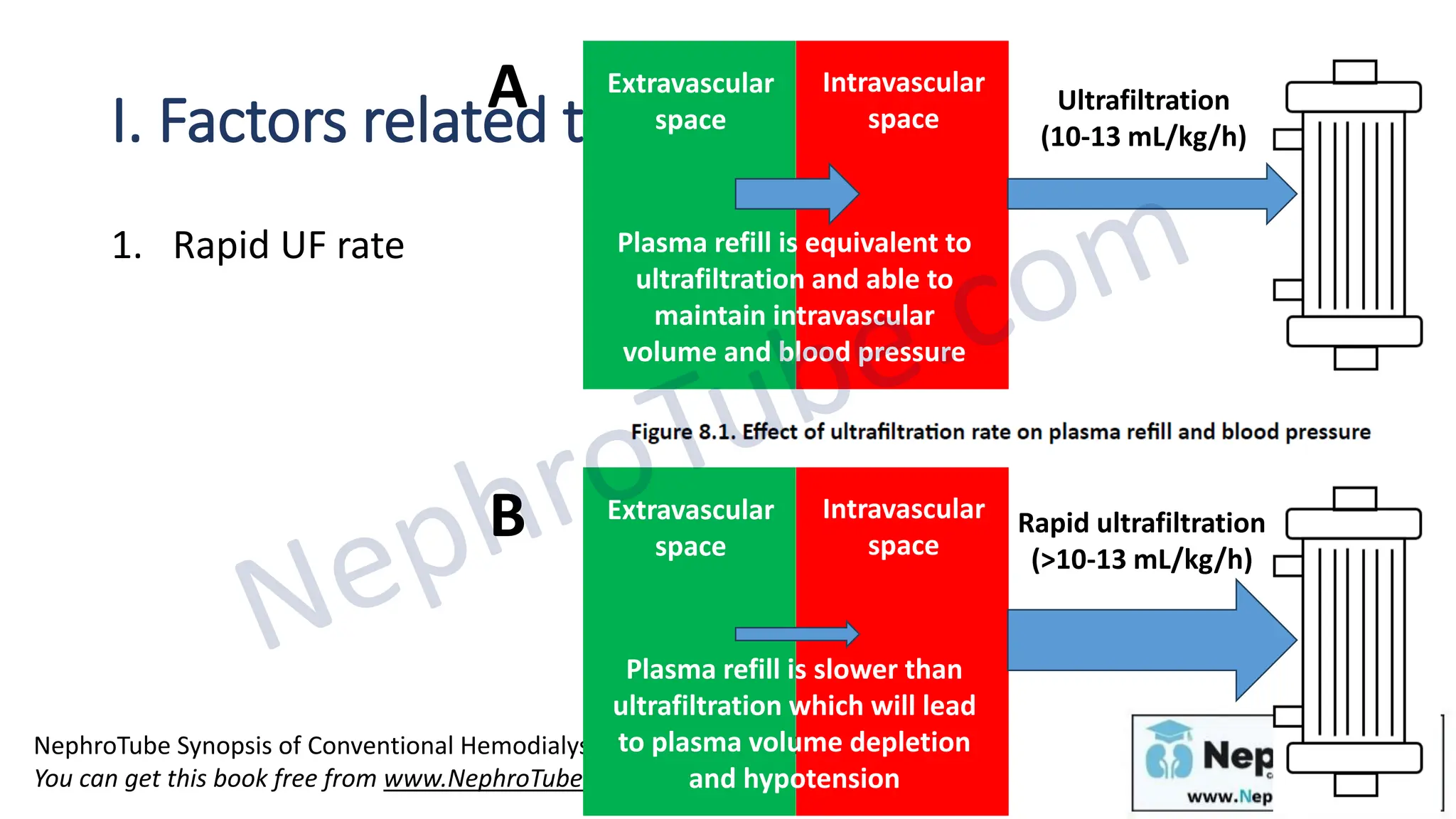 Hemodialysis: Chapter 8, Complications During Hemodialysis, Part 1 - Dr ...
