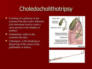 Chapter 8 digestive system | PPT