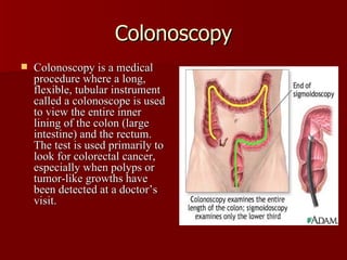 Chapter 8 digestive system | PPT
