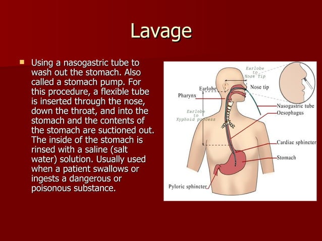Chapter 8 digestive system | PPT