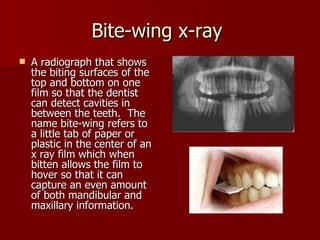 Chapter 8 digestive system | PPT