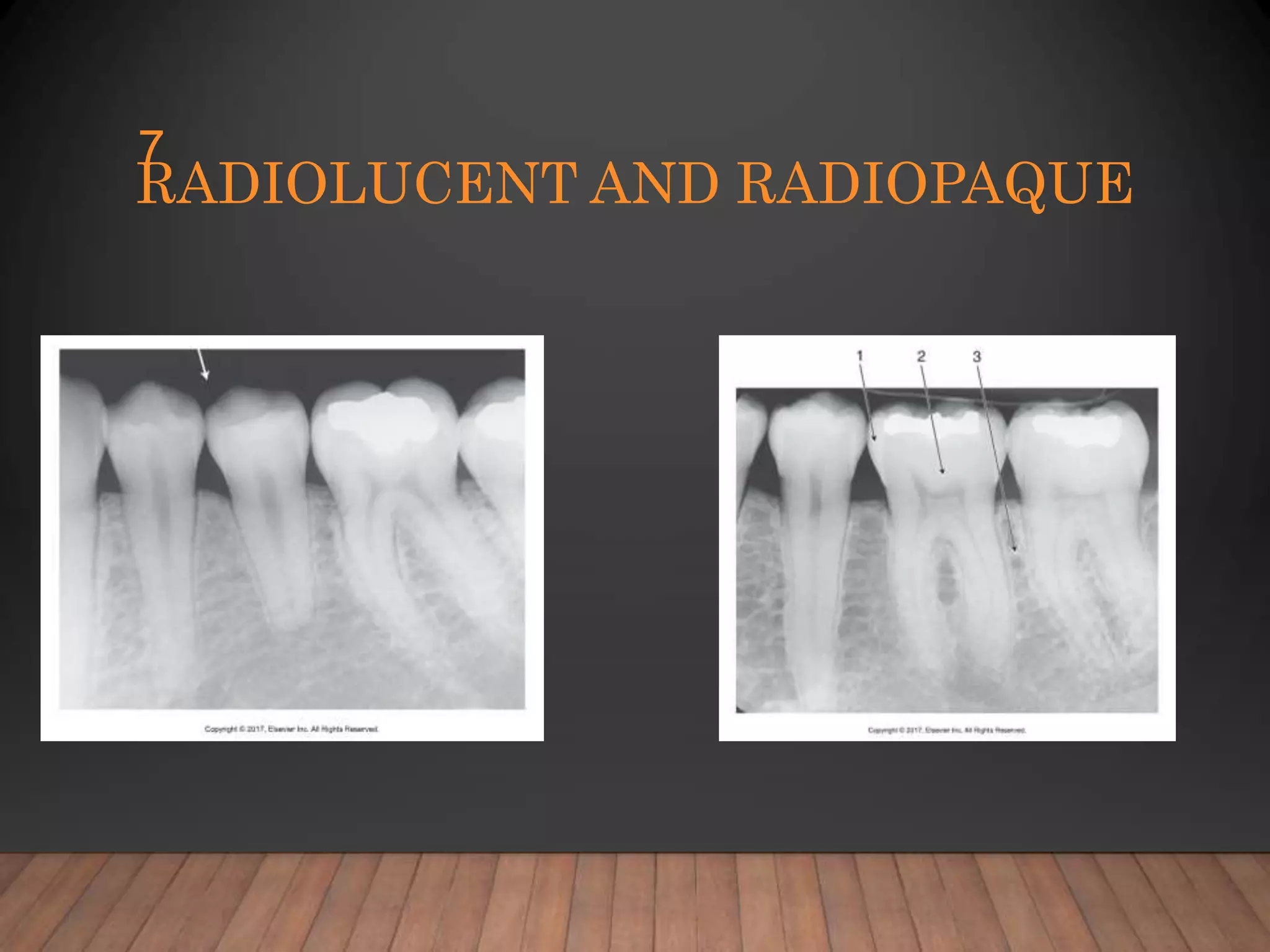 Chapter 8: Image Characteristics | PPT