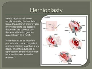 Chapter 8 presentation | PPT