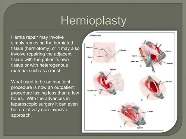 Chapter 8 presentation | PPT