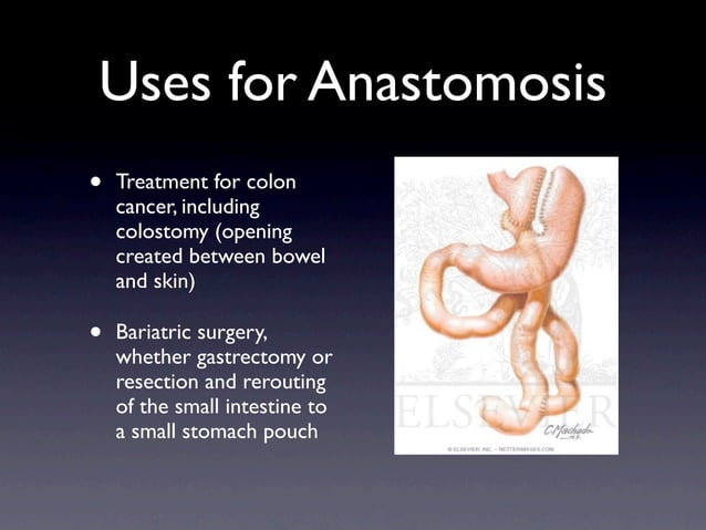 Chapter 8 presentation | PPT