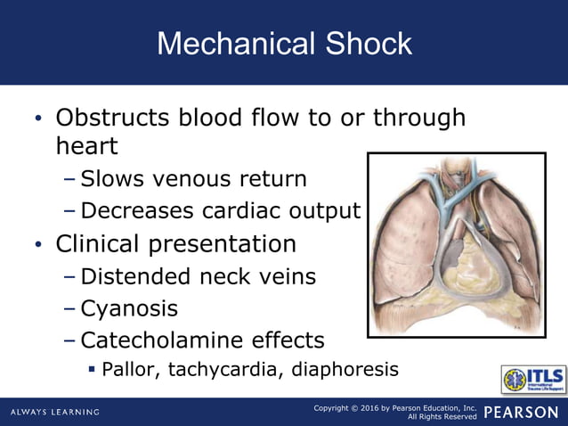 Chapter8 shock | PPT | First Aid | Injuries
