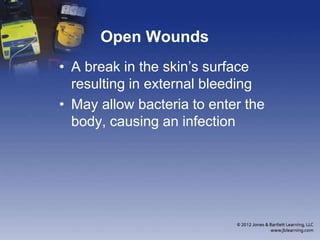 Chapter 9 Wounds | PPTX