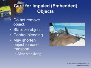 Chapter 9 Wounds | PPT