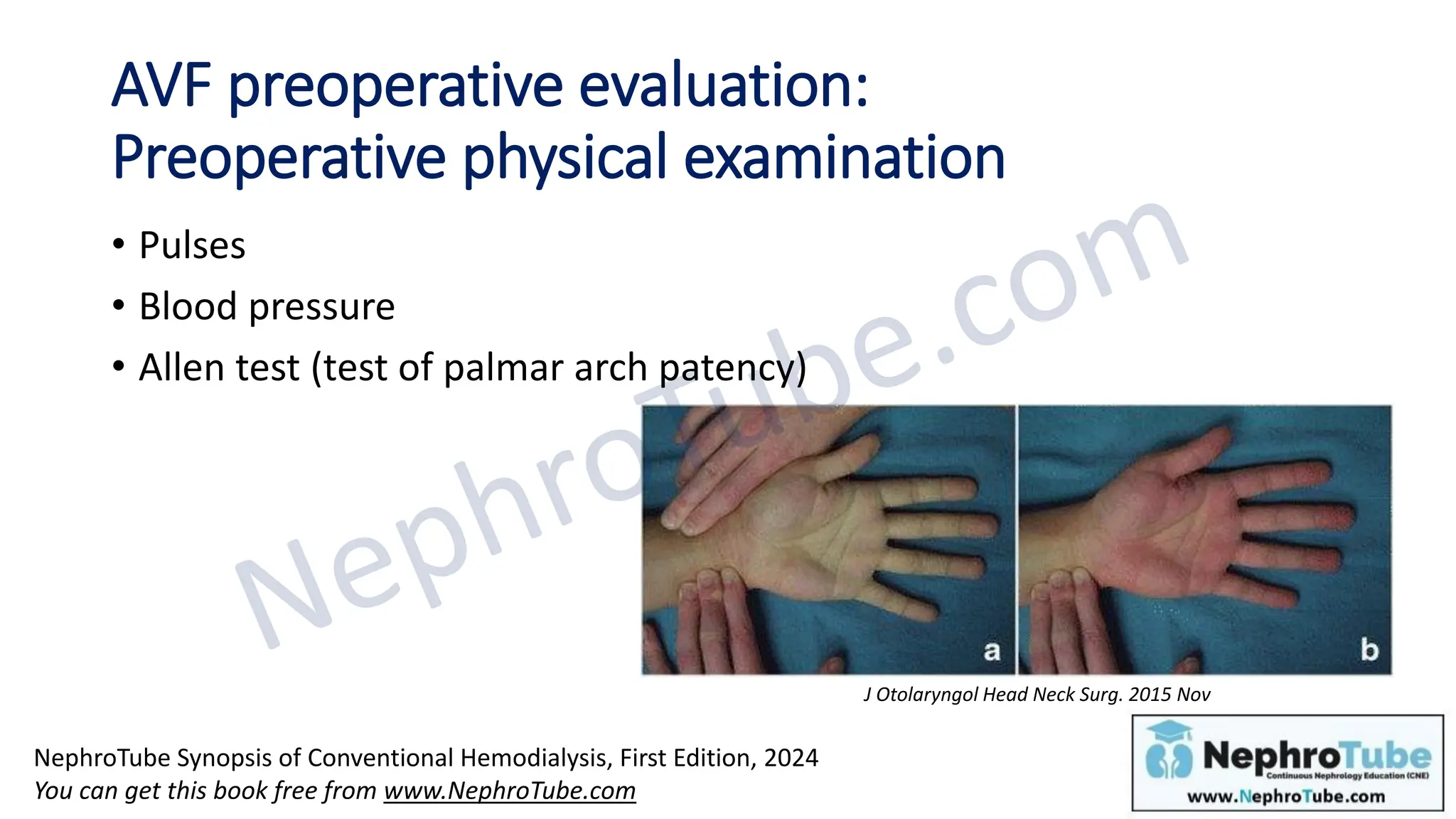 Hemodialysis: Chapter 9, Arteriovenous Fistula and Graft: Basics ...