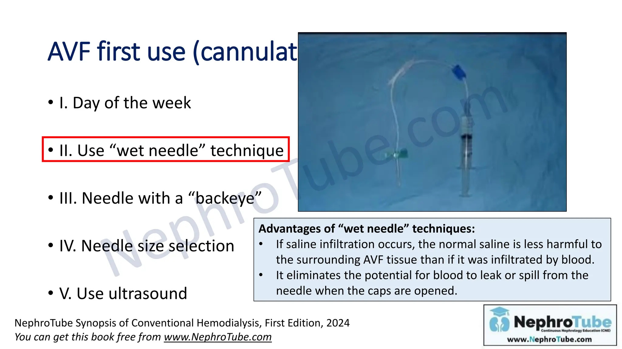 Hemodialysis: Chapter 9, Arteriovenous Fistula and Graft: Basics ...