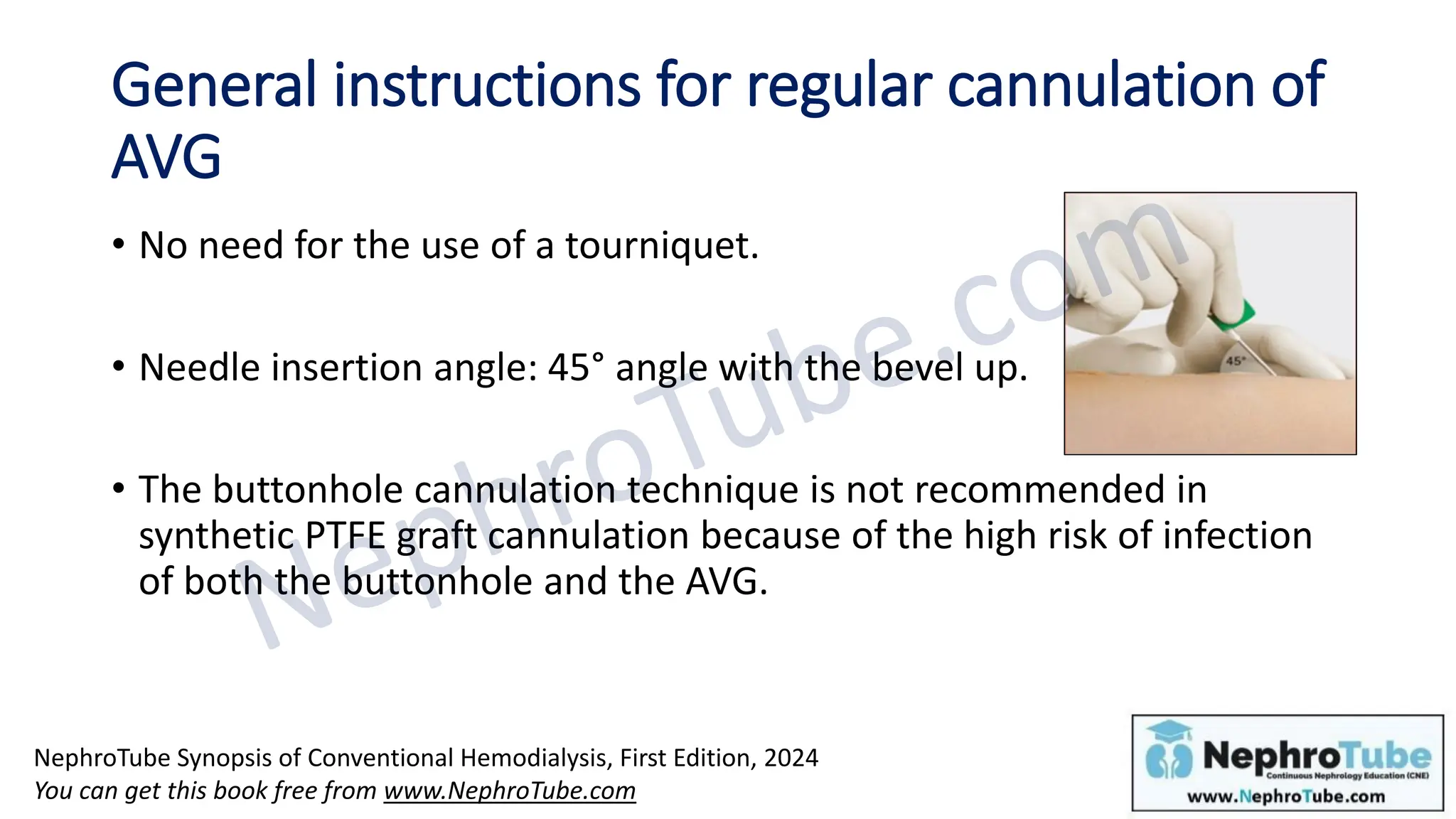 Hemodialysis: Chapter 9, Arteriovenous Fistula and Graft: Basics ...