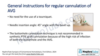 Hemodialysis: Chapter 9, Arteriovenous Fistula and Graft: Basics ...