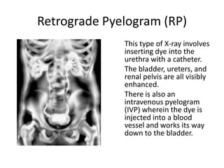 Chapter 9 presentation | PPT