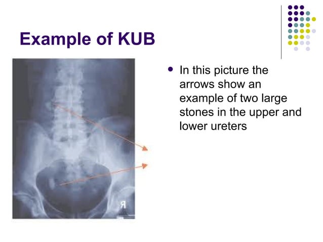 Chapter 9 urinary system | PPT
