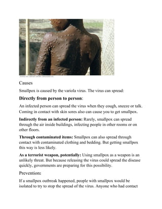 Diseases-Cause and Prevention Chp-5 General Science 9th 10th | PDF