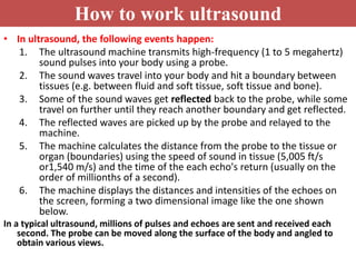 Chapter one Basic Ultrasound | PPT