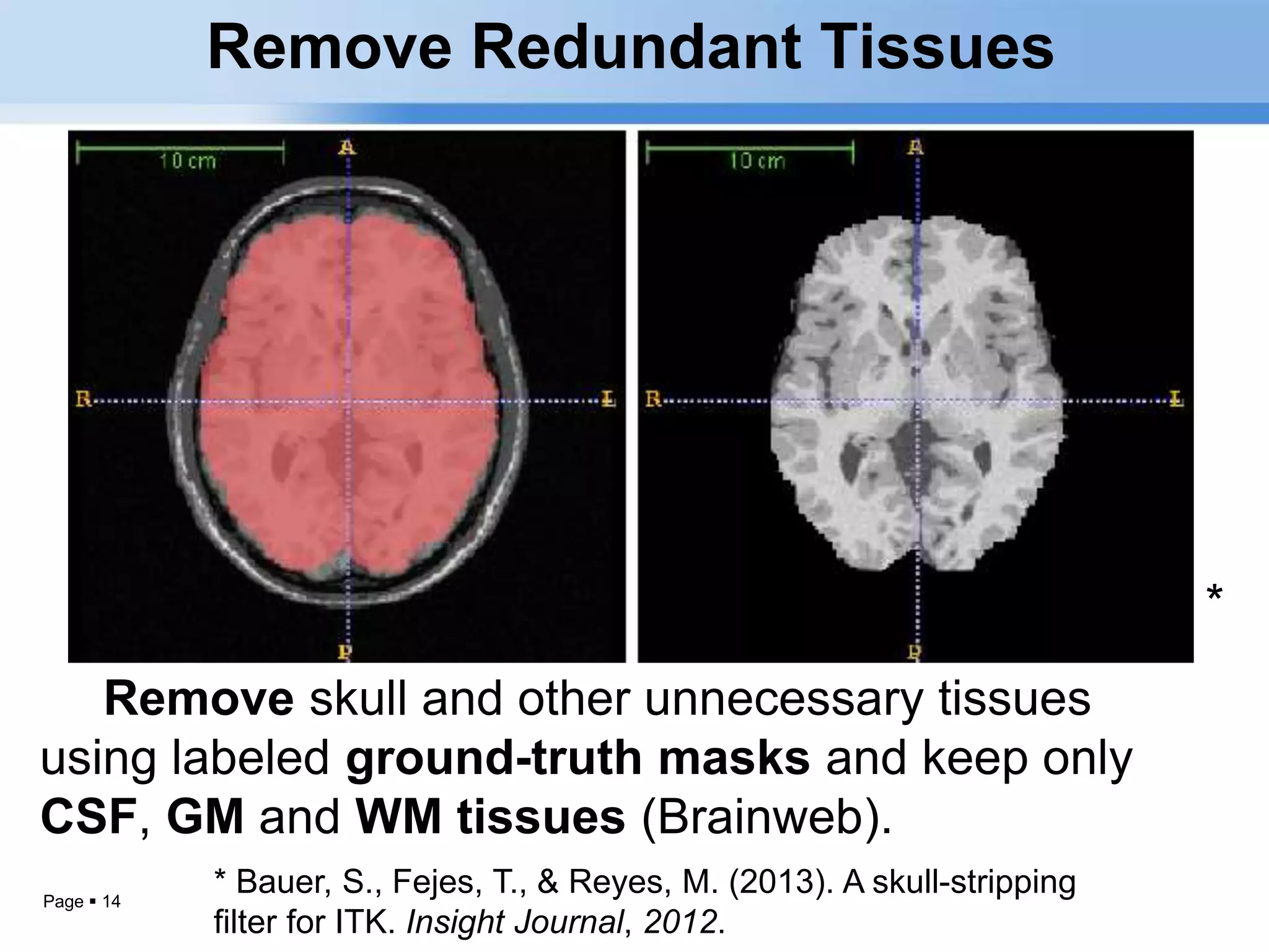 Tissue Segmentation Methods Using 2d Histogram Matching In A Sequence Of Mr Brain Imagespart2