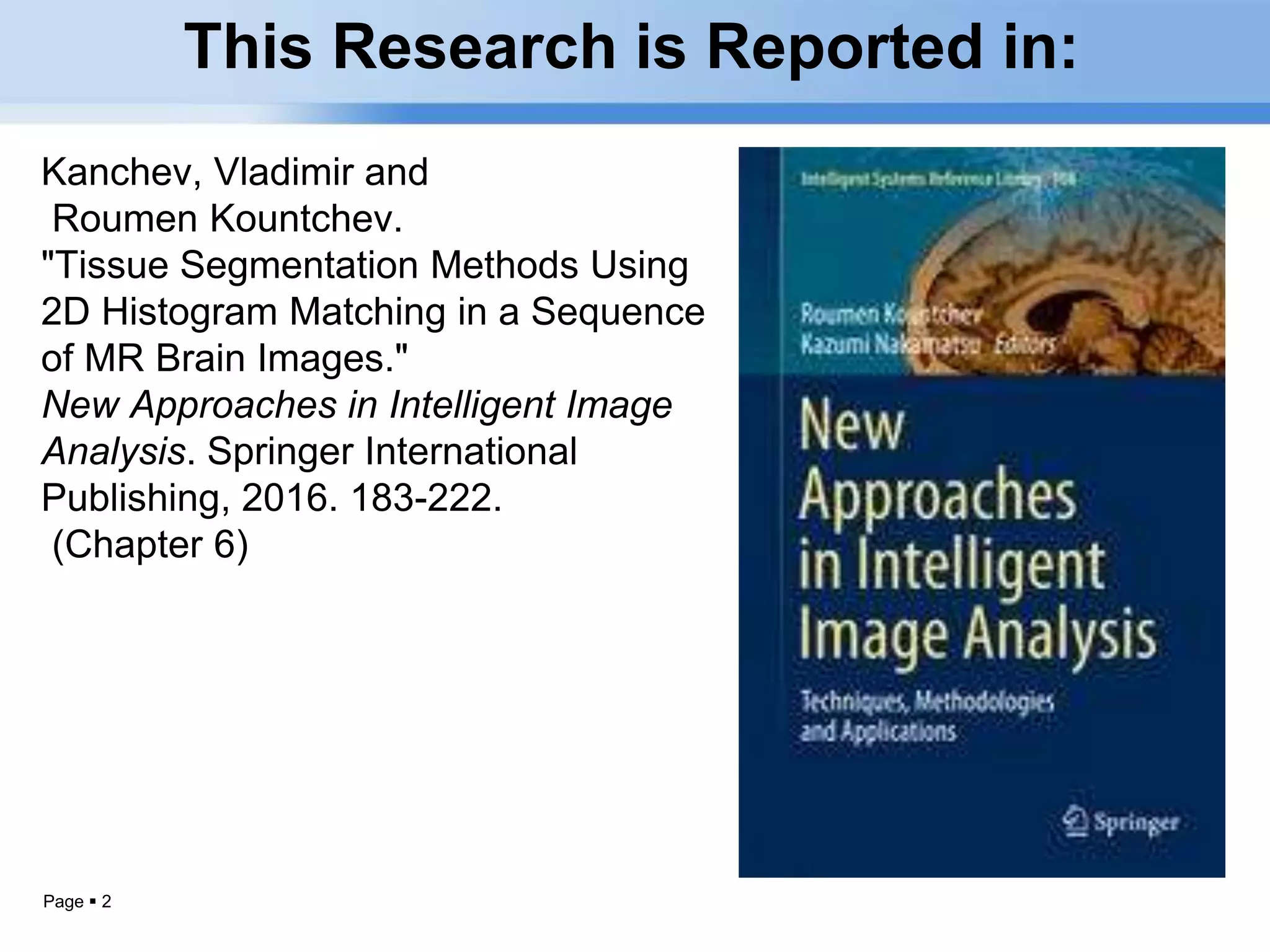 Tissue Segmentation Methods Using 2d Histogram Matching In A Sequence Of Mr Brain Imagespart2