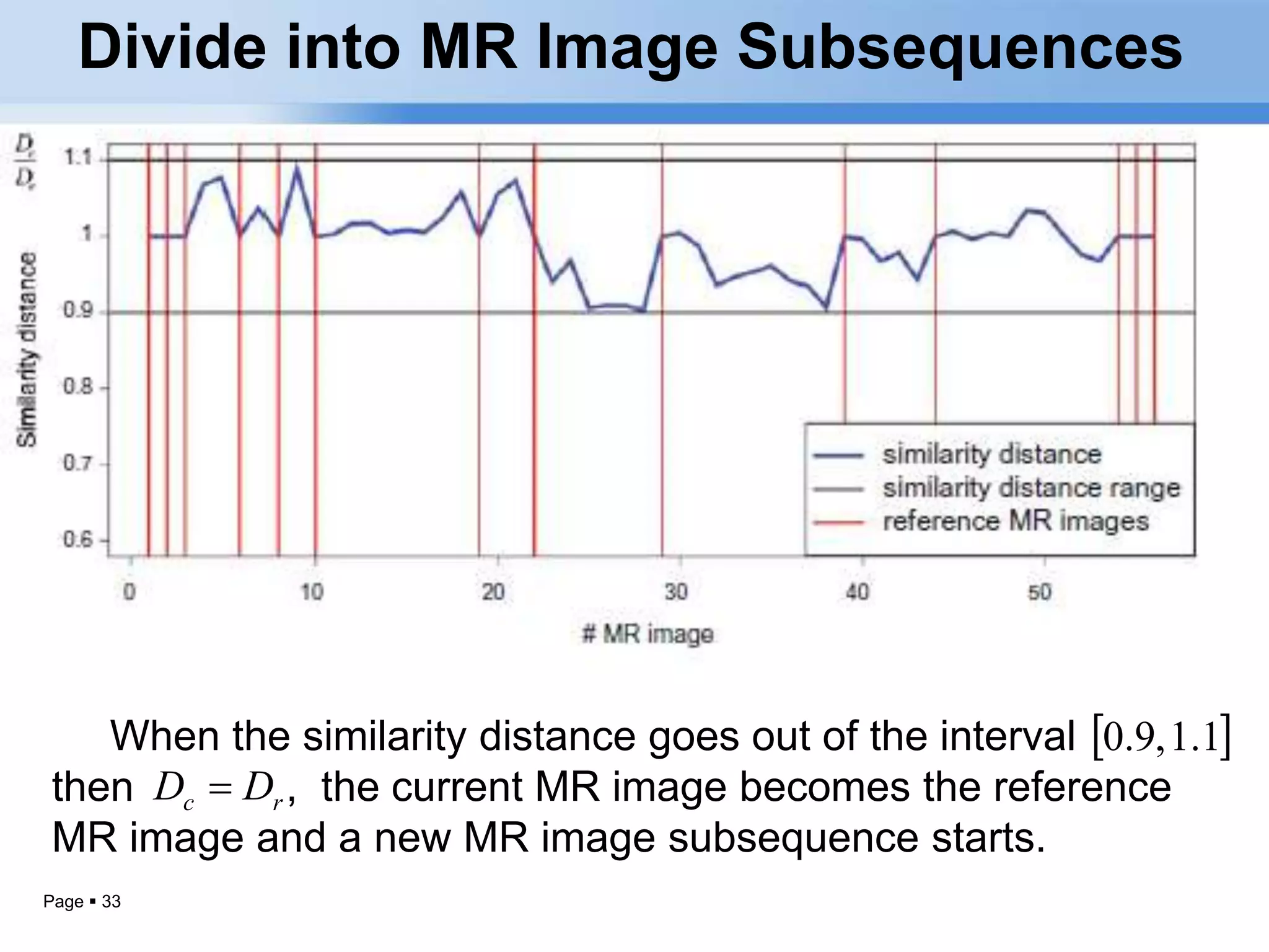Tissue Segmentation Methods Using 2D Histogram Matching in a Sequence of MR Brain Images_part2 ...