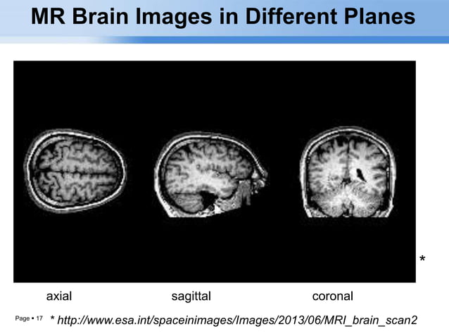 Tissue Segmentation Methods Using 2D Histogram Matching in a Sequence of MR Brain Images_part2 ...