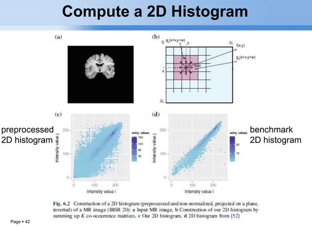 Tissue Segmentation Methods Using 2d Histogram Matching In A Sequence Of Mr Brain Imagespart2