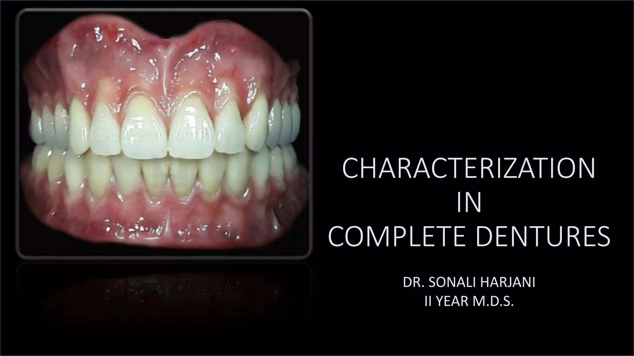 Characterization in complete dentures | PPTX