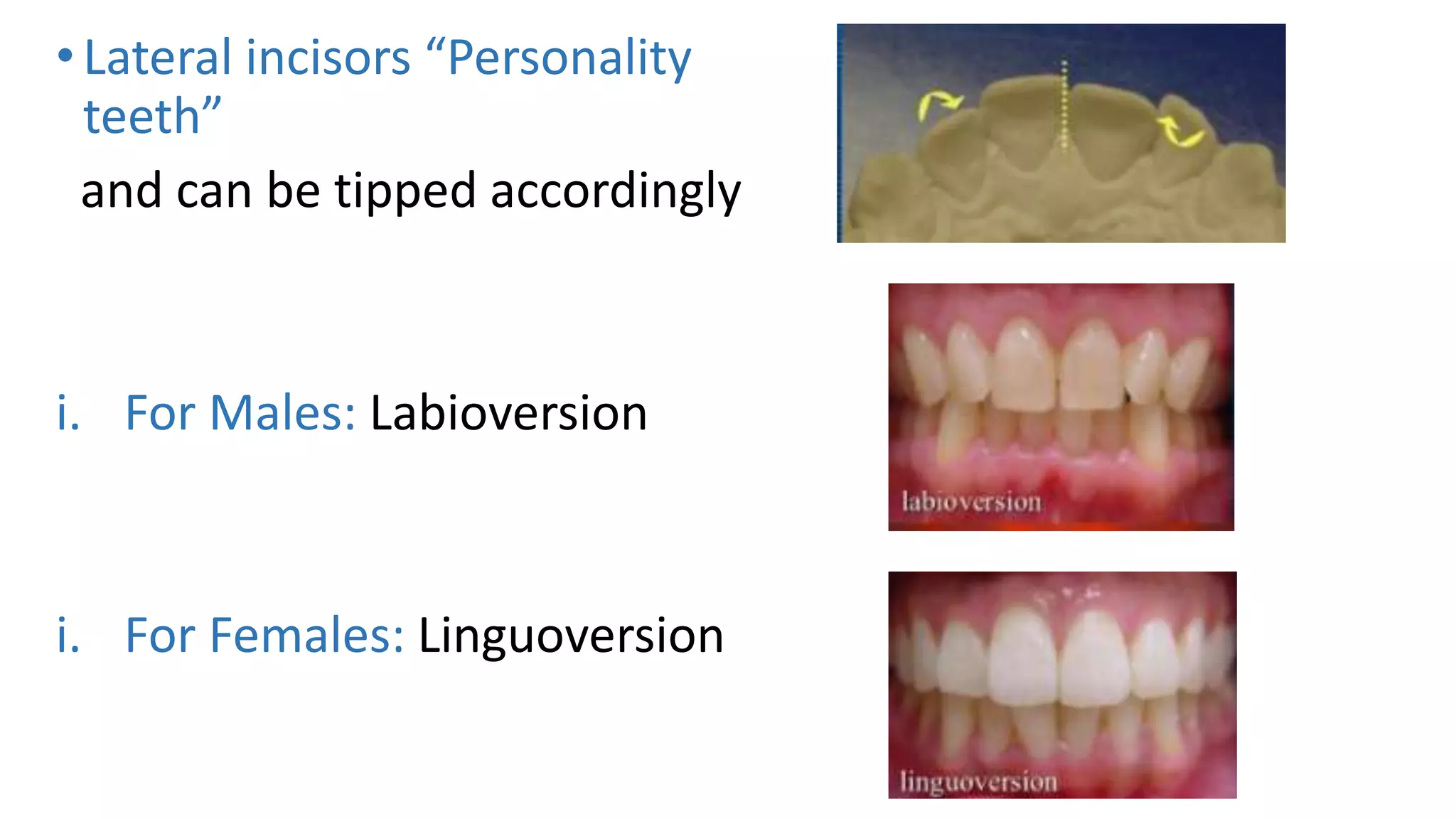 Characterization in complete dentures | PPTX