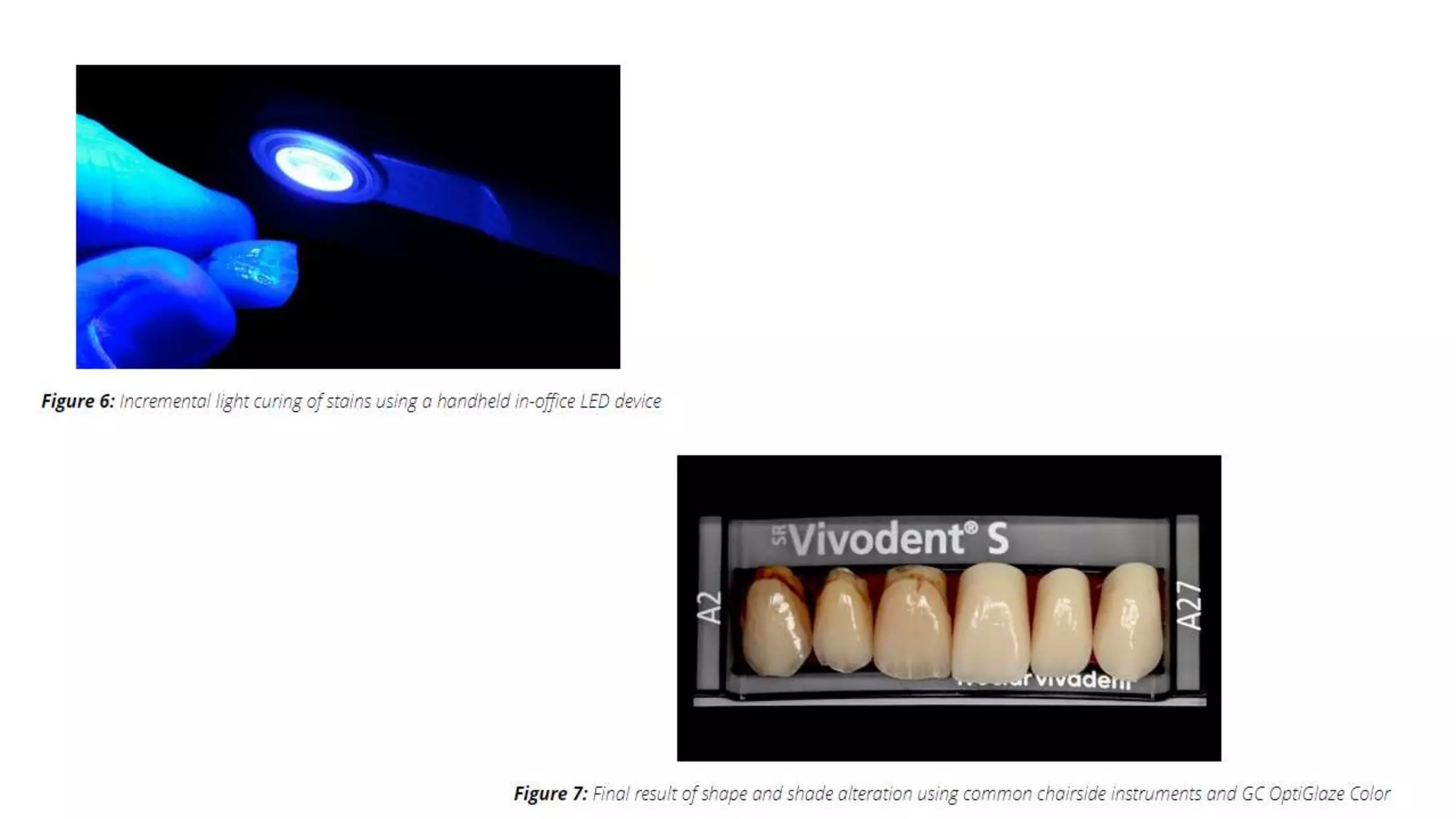 Characterization in complete dentures | PPTX