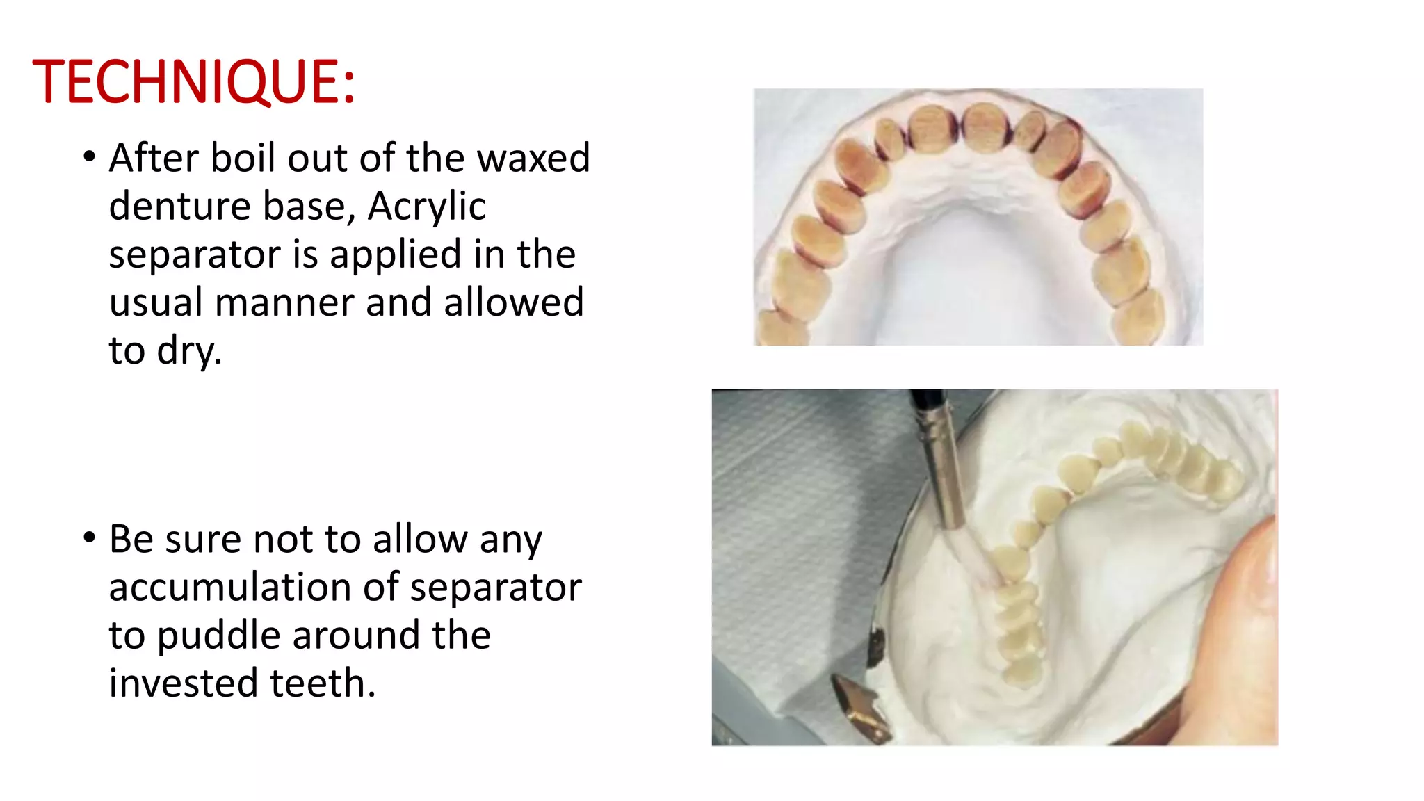 Characterization in complete dentures | PPTX