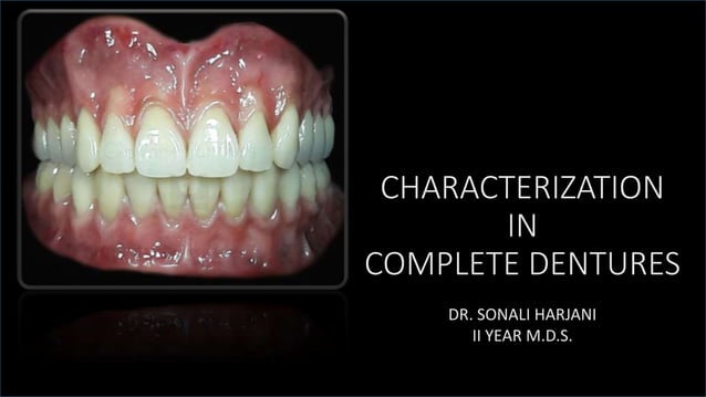 Characterization in complete dentures | PPTX | Dental Health | Diseases ...