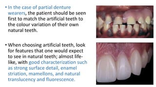 Characterization in complete dentures | PPTX