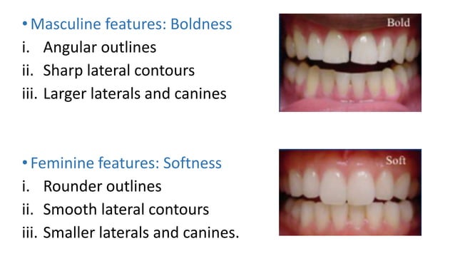 Characterization in complete dentures | PPTX | Dental Health | Diseases and Conditions