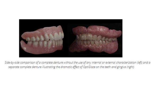 Characterization in complete dentures | PPTX | Dental Health | Diseases ...