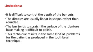 Characterization in complete dentures | PPTX