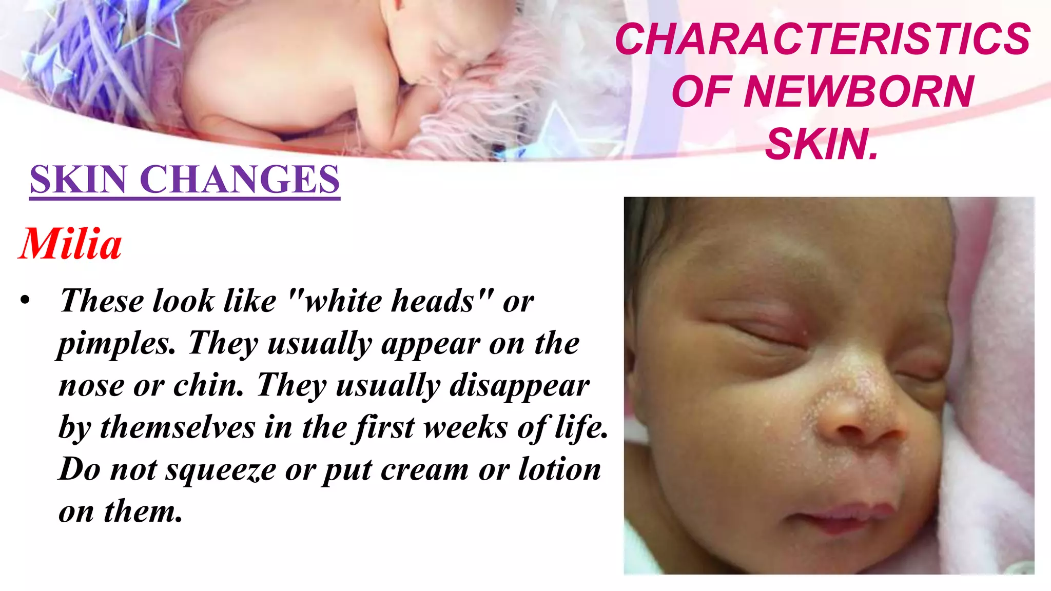 Characteristic of newborn and reflexes | PPTX