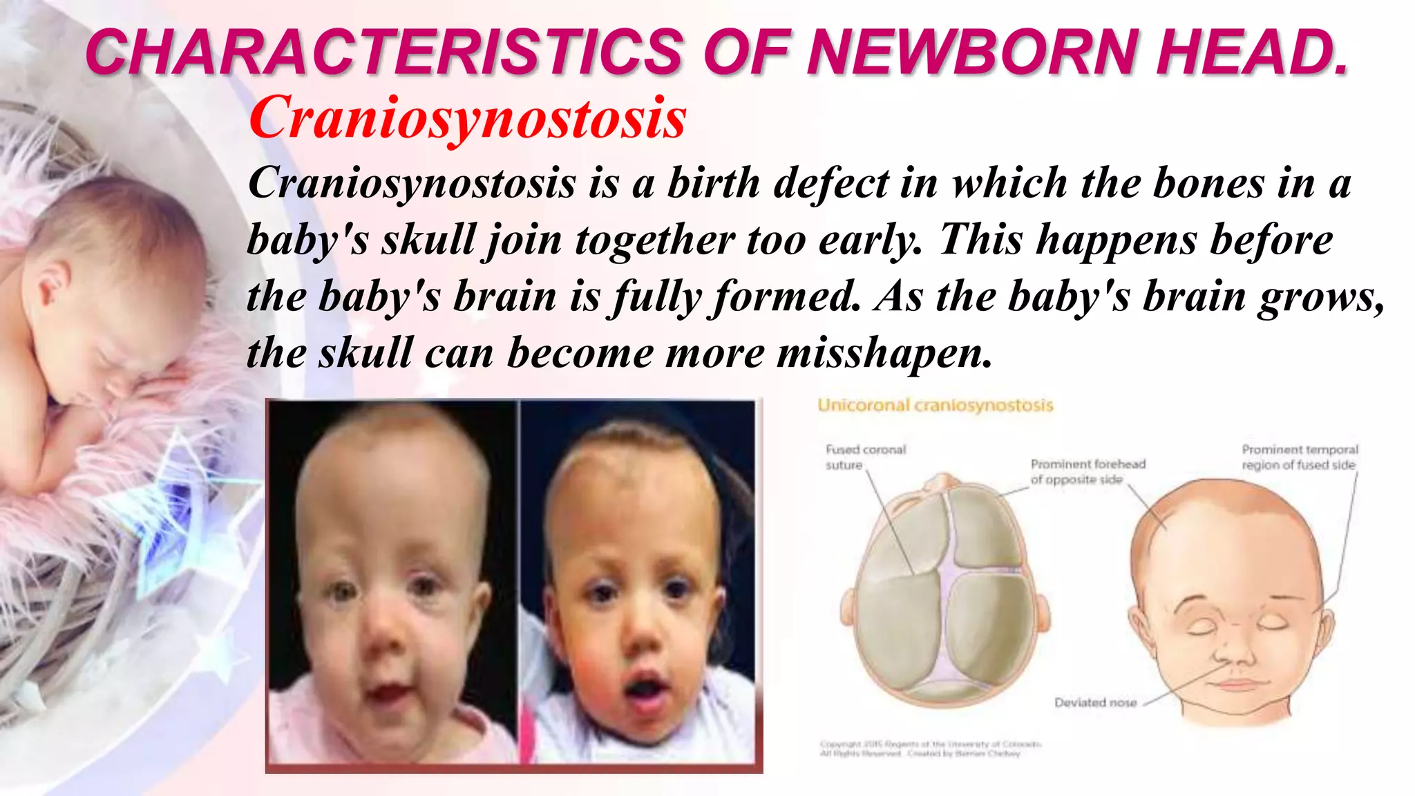 Characteristic of newborn and reflexes | PPTX