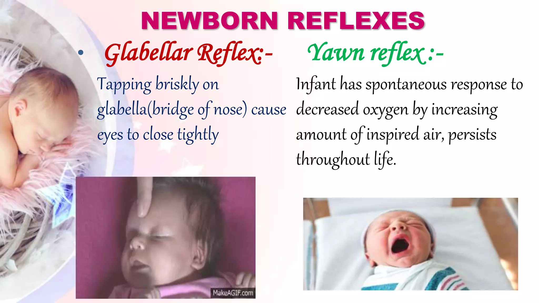 Characteristic of newborn and reflexes | PPTX