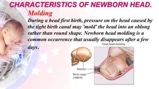 Characteristic of newborn and reflexes | PPTX