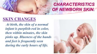 Characteristic of Newborn And reflexes.pptx