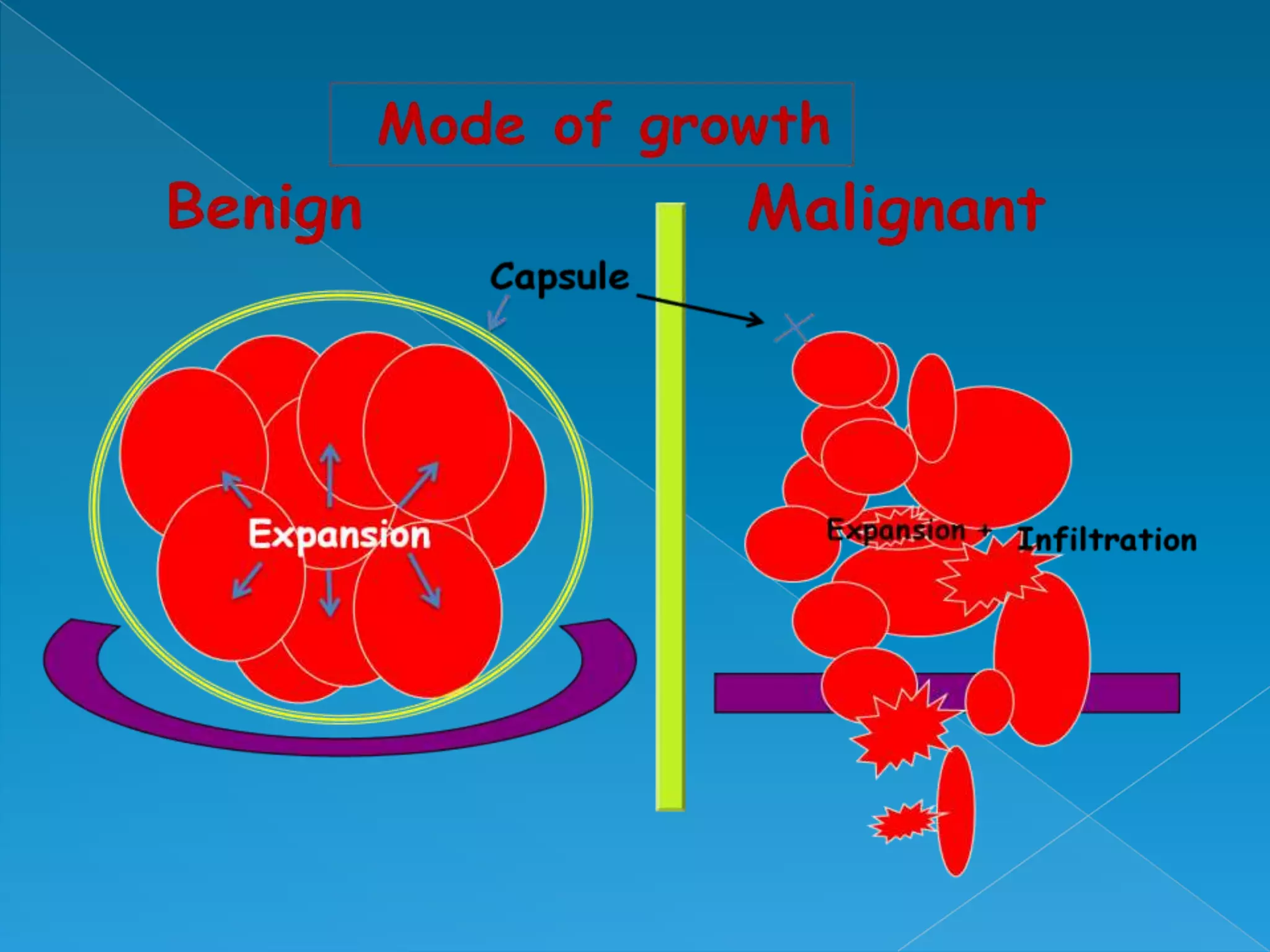 Characteristics of benign and malignant neoplasms | PPTX